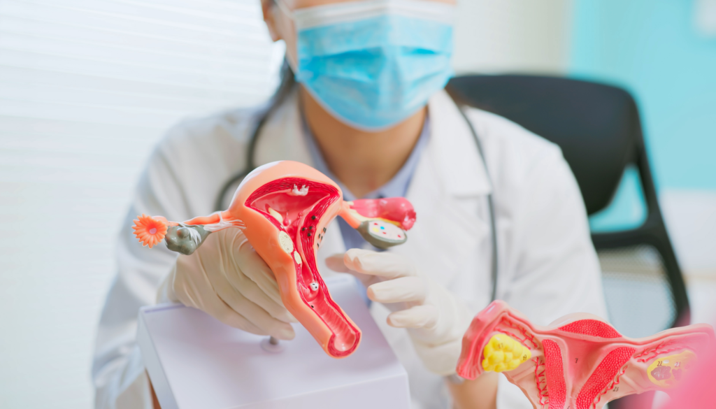 What Type of PCOS Do You Have? A Simple Guide to Finding the Right ...