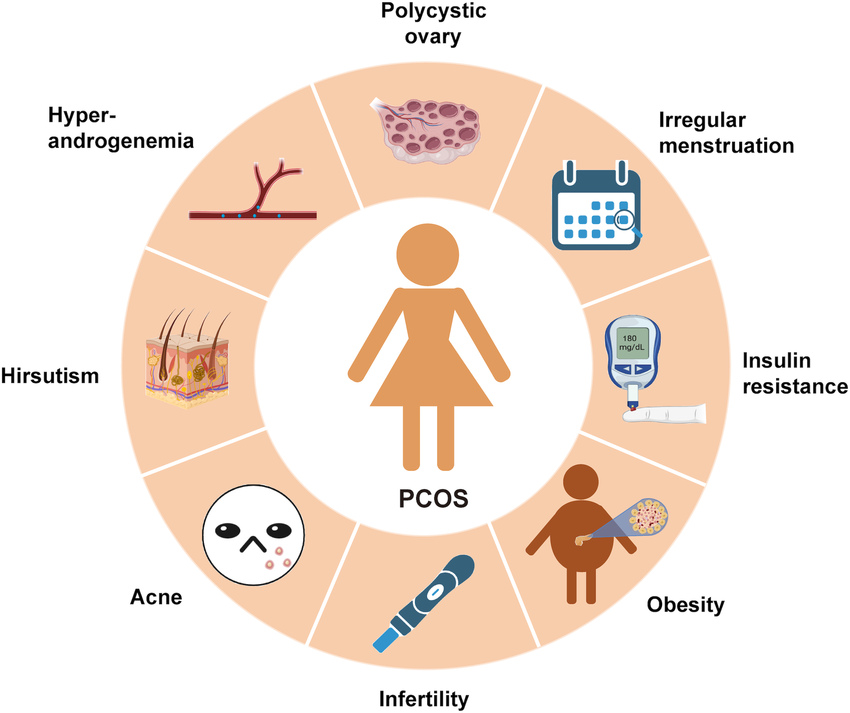 Why Gynoessence Works — Ingredient Mechanisms in PCOS Management ...